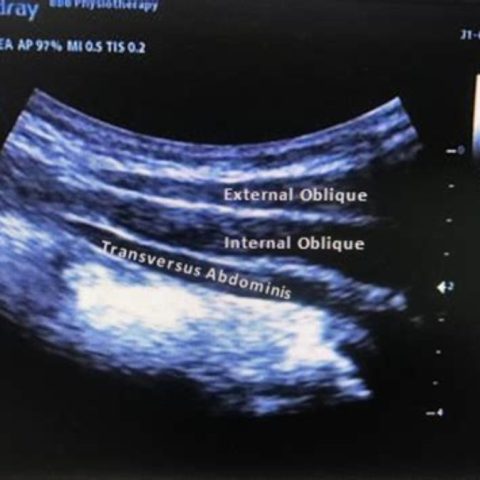 Real Time Ultrasound - Sydney Women's Physiotherapy